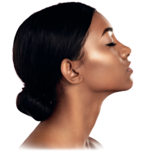 Spectra Laser Toning Before and After Photos Brea - Med Spa Gallery ...